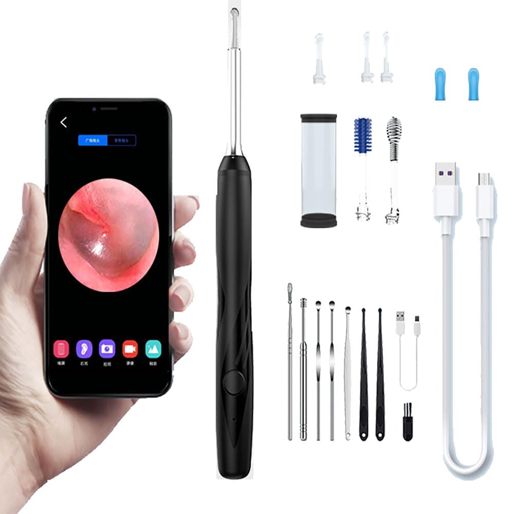 Ear Wax Removal Kit with Camera and Light - 1080P Ear Camera for iOS ...