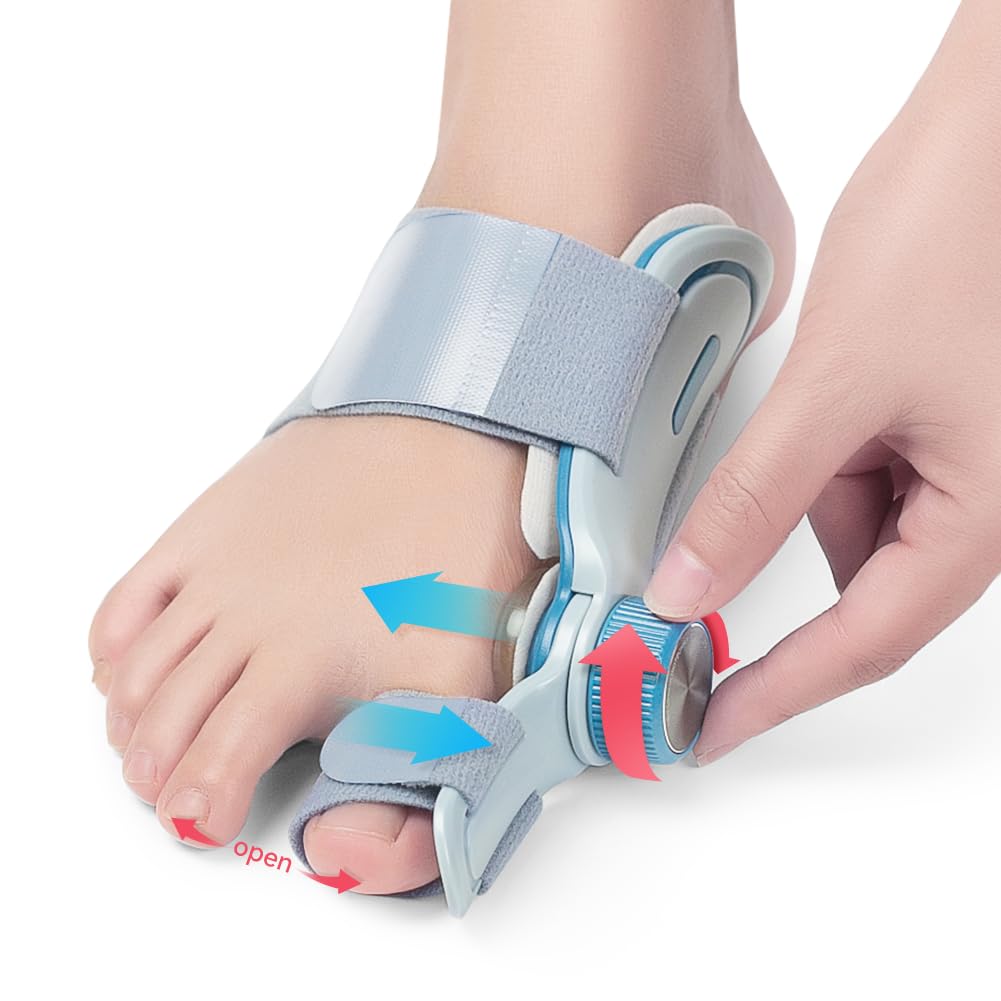 Tech Love Hallux Valgus Correction - Upgrade Fixing Plate & Rail ...