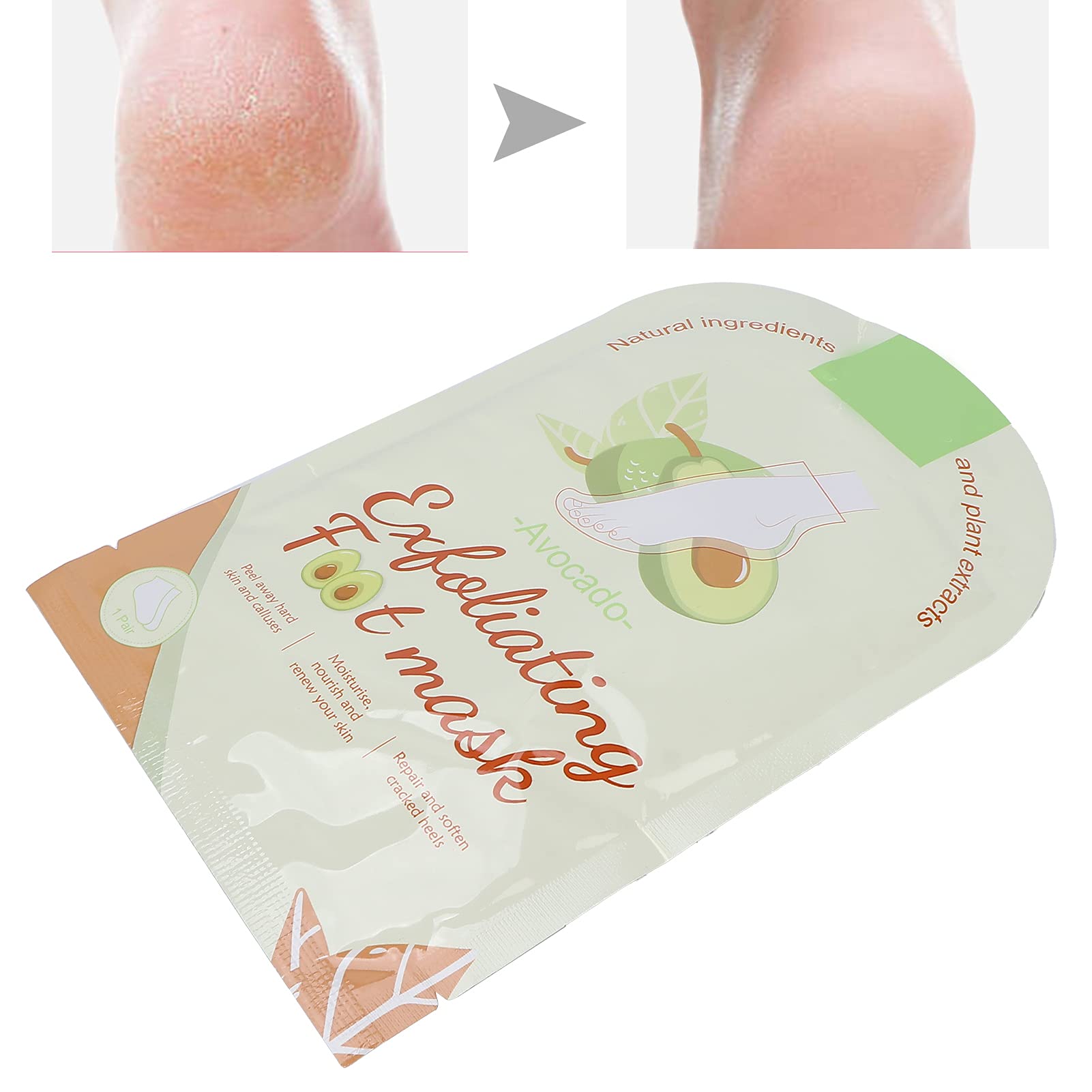Ultimate Foot Peeling Mask for Cracked Heels | Moisturizing Avocado ...