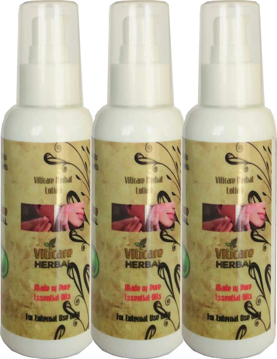 Viticare Herbal Lotion for Vitiligo Treatment | All Natural ...