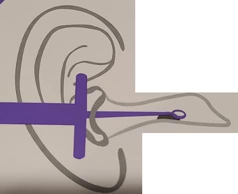 Ototek Loop Ear Wax Removal Device - Available in Various Colors | Buy ...