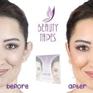 EARLAP Cosmetic Ear Corrector - Non-surgical Solution for Prominent ...