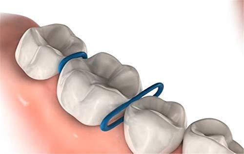 Fencia 1000 Pcs Blue Dental Orthodontic Separator Elastic Bands ...