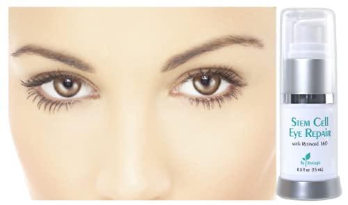 Stem Cell Therapy Eye Repair with Retinoid 160 - Reduce Fine Lines ...
