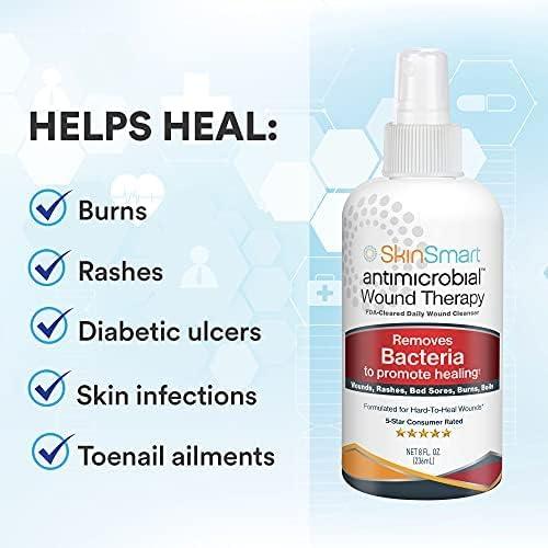 SkinSmart Antimicrobial Wound Therapy 8oz Clear Spray - Hypochlorous ...