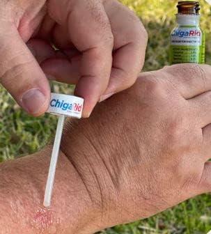 Chigarid External Analgesic - 0.5 oz (Pack of 2) - Fast-Acting Pain ...