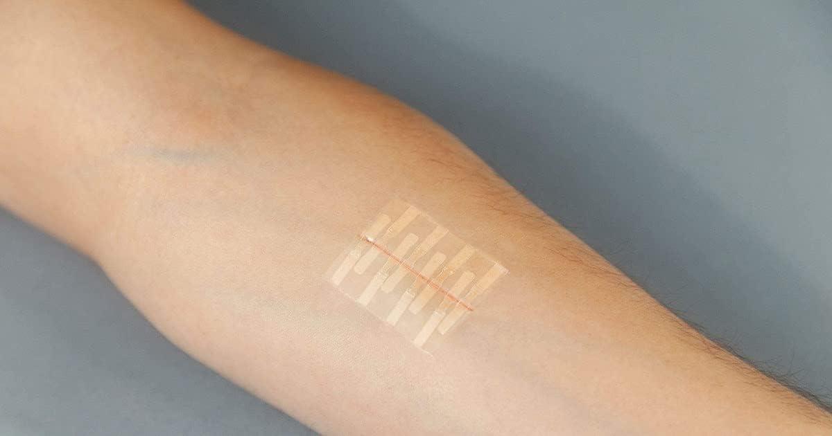 Clozex Emergency Laceration Closures - Repair Wounds Without Stitches ...