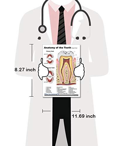 Tooth Anatomy & Implant Repair Support Card Set - Enhance Dental ...