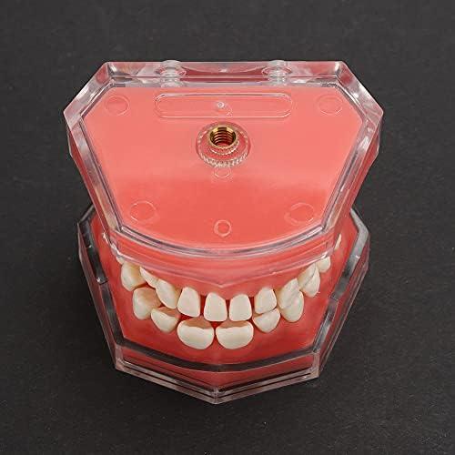 Gingiva Model for Dental Training | Removable Tooth & Oral ...