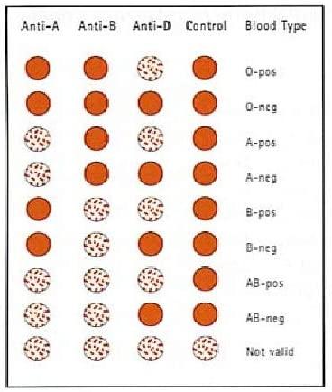 Eldoncard Blood Type Test Kit - 3 Tests | ABO AB & Rh Grouping ...