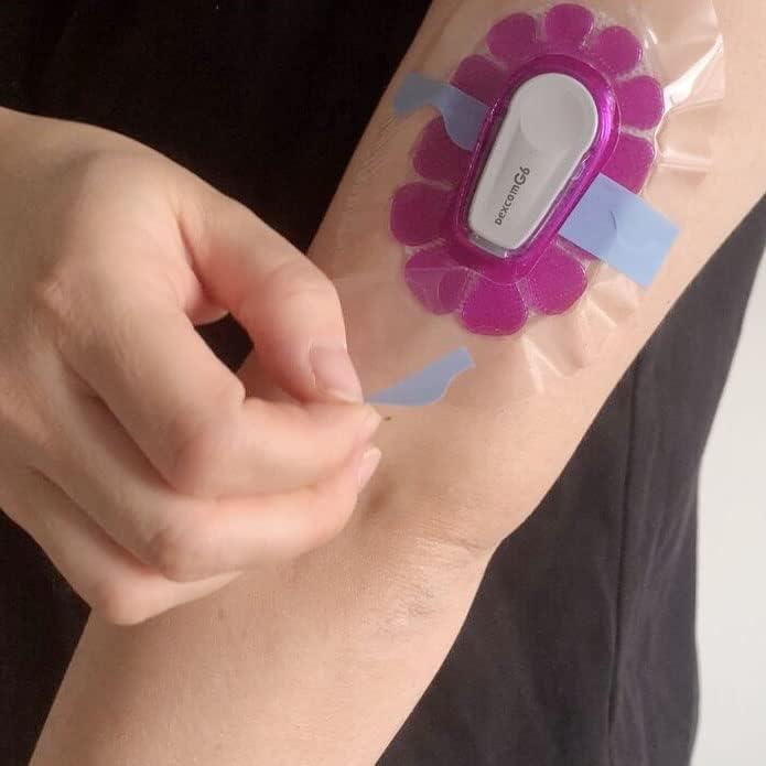 Dexcom G6 Adhesive Patches-40 Pack | Invisible Waterproof G6 Overpatch ...