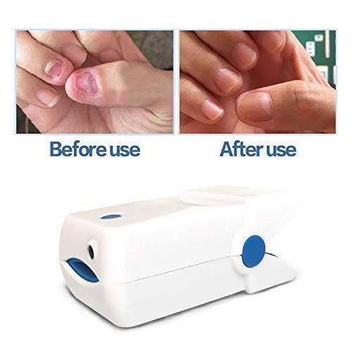 MAGNETOE Portable Nail Therapy Device | October 2021 Edition for Toes ...