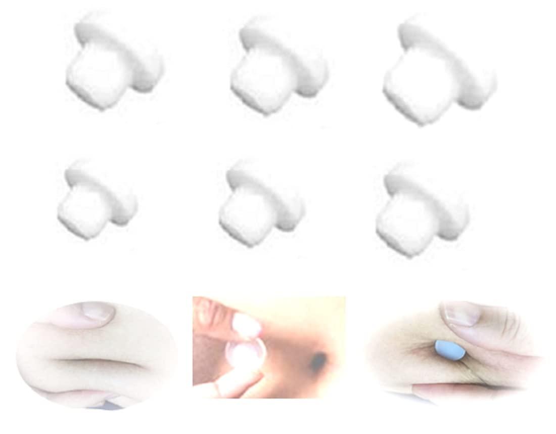6pcs T-Shaped Silicone Belly Button Plugs for Tummy Tuck & Hernia ...