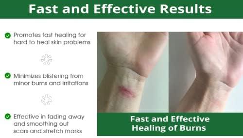 Dermalere Advanced Burn and Scar Cream - Fast Healing Face and Body ...