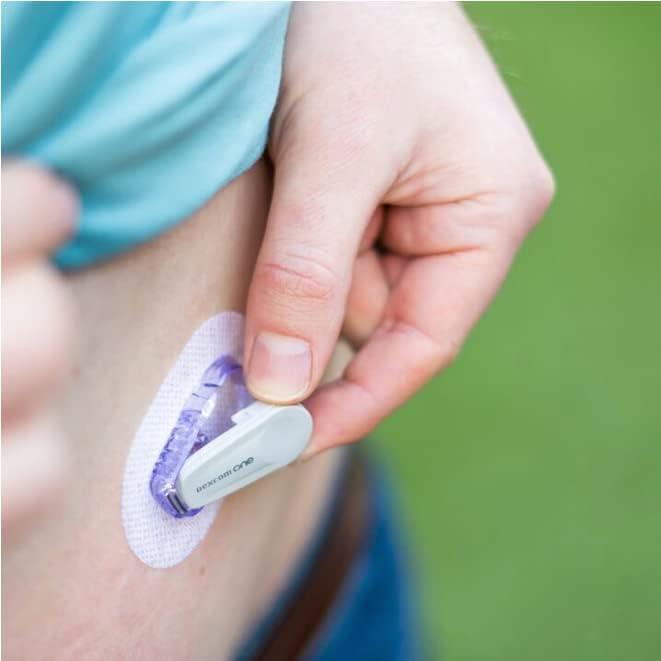 Dexcom One Sensor 3-Pack with Transmitter for Diabetes Monitoring | Buy ...