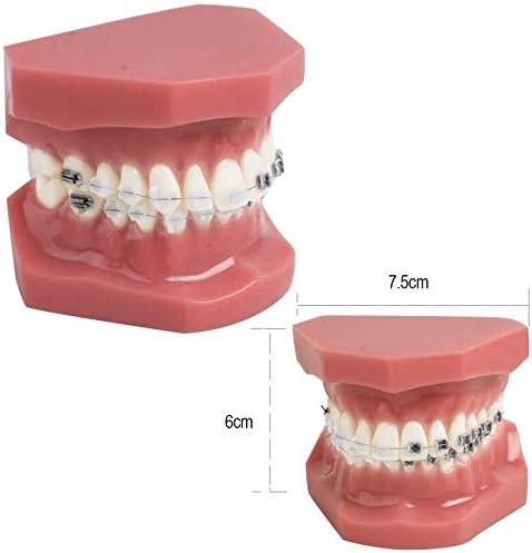 ERNZI Dental Template Orthodontic Model - Semi-Ceramic Half Mount for ...
