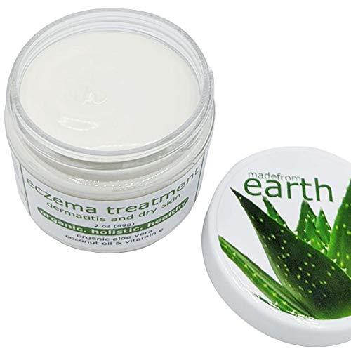 Made from Earth Eczema Cream with Aloe & Vitamin E - 2oz | Soothes Dry ...