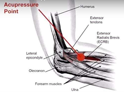 Thera Point Acupressure Tennis Elbow Brace - Relief for Tendonitis ...