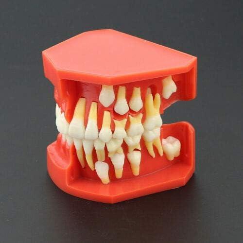 Buy Dental Study Teeth Model with Removable Gums & Permanent Teeth ...