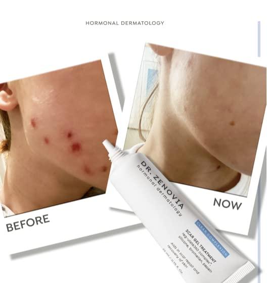 Dr. Zenovia Hormonal Dermatology Scar Gel Treatment - Silicone Cream for Face & Body | Buy Now ...