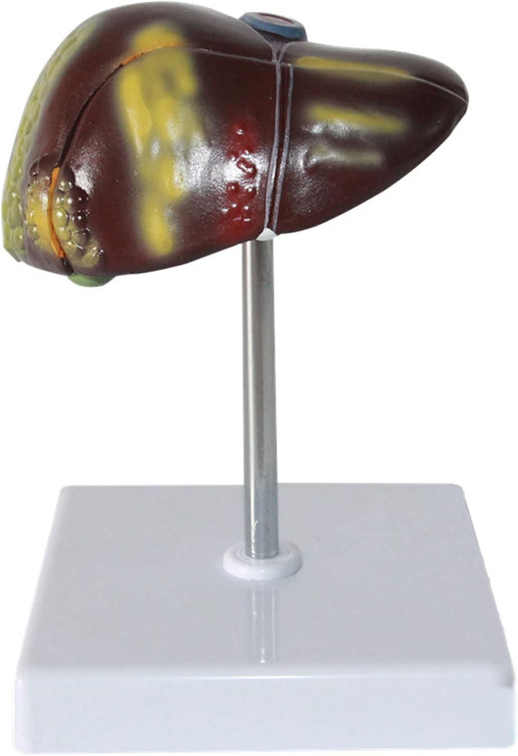 Liver Anatomy Model Human Liver Disease Model Liver Fat/Cirrhosis ...