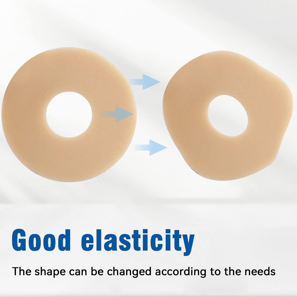 Ostomy Barrier Rings - Mouldable Colostomy Rings for Stoma Care ...