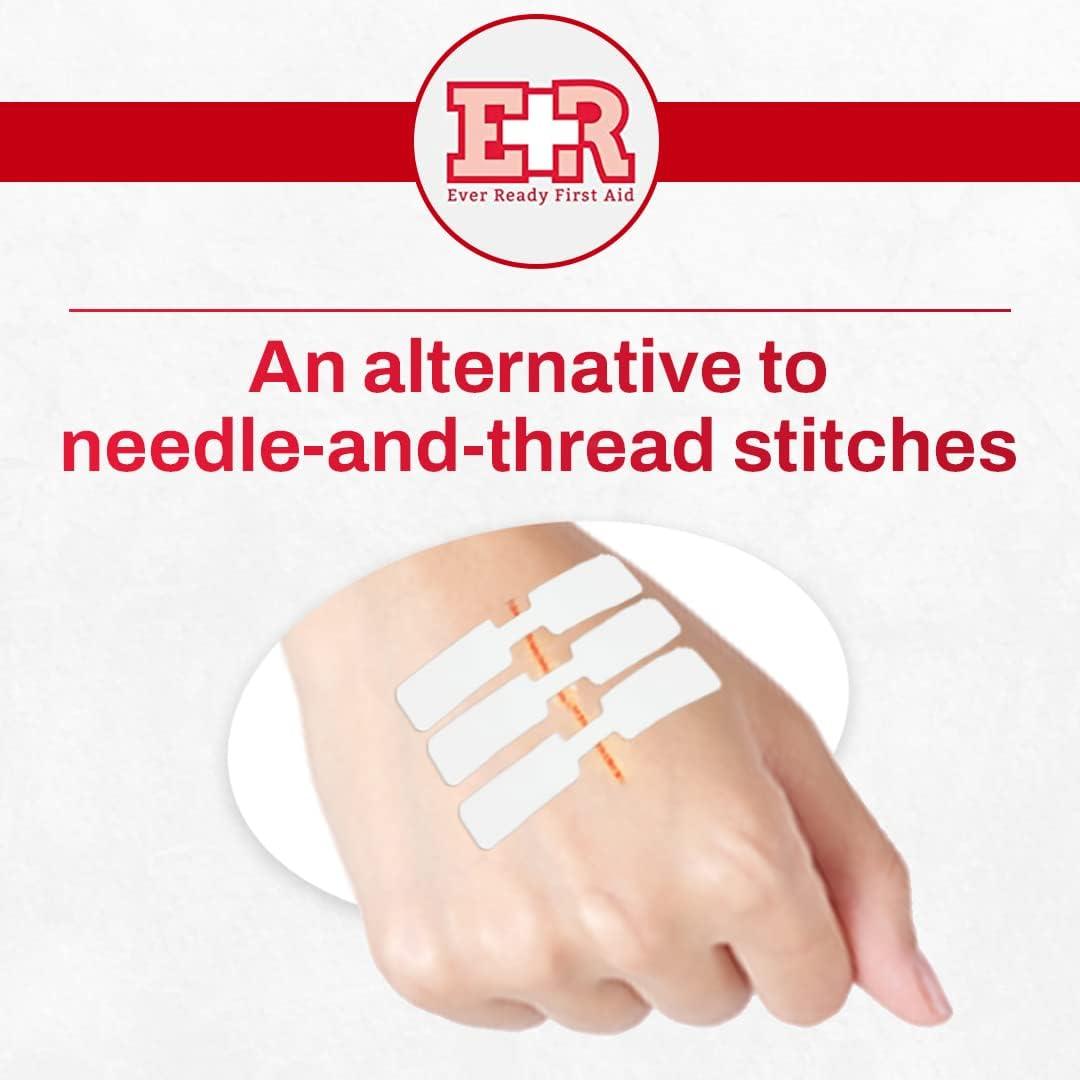 100 Count Sterile Butterfly Strips for Small Wound Closure - 2 Pack ...