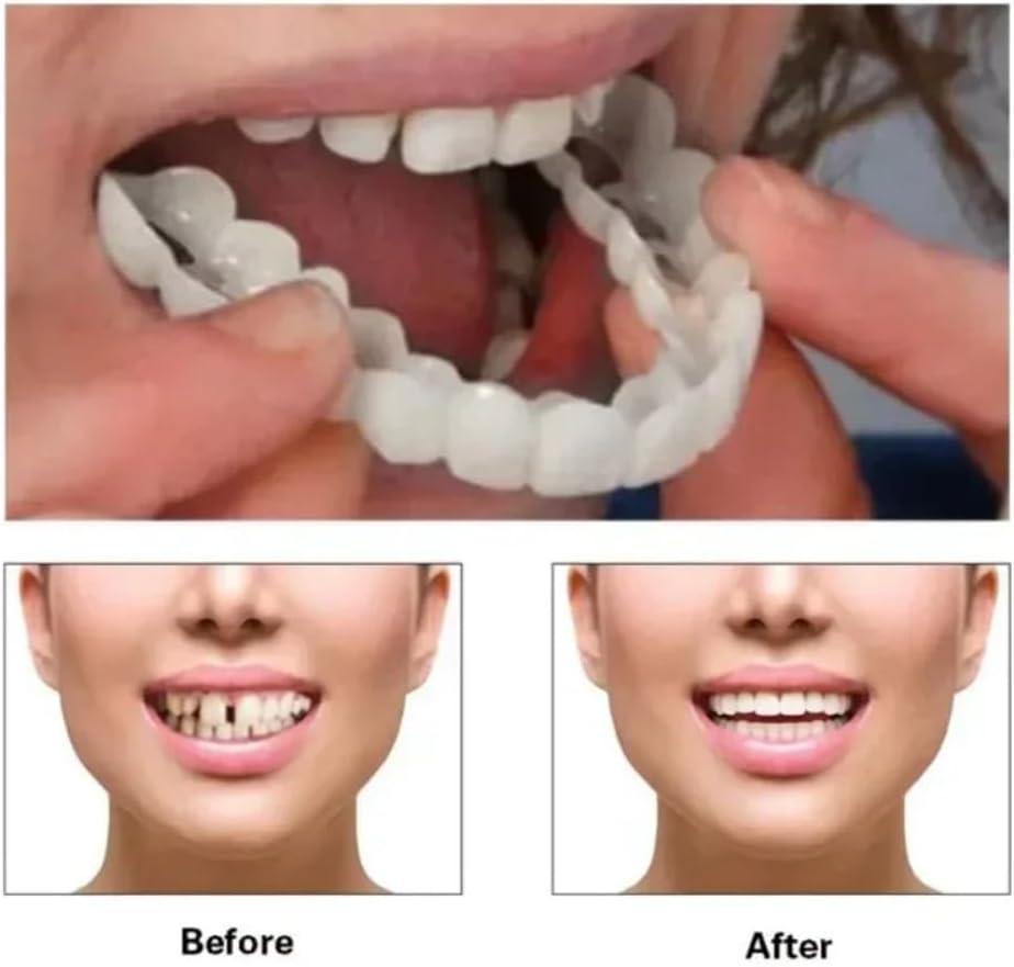 Iksvmsi Protheses Fake Teeth - 2 Pairs of Temporary False Teeth Veneers ...