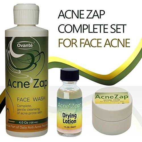 Acne Zap Drying Lotion - Overnight Acne Spot Treatment Dries Out ...