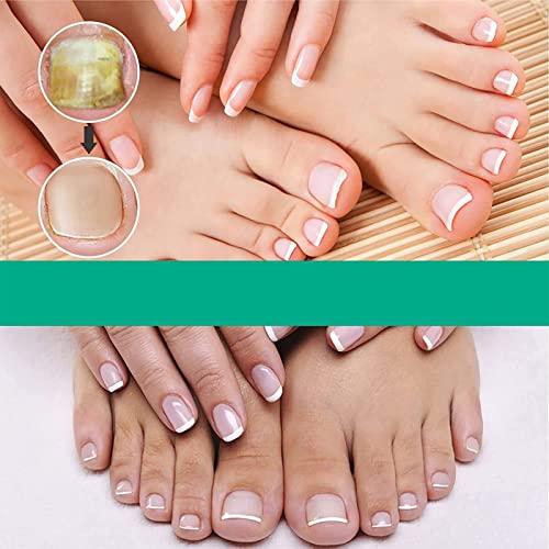 Kerassentials Toenail Treatment Extra Strength - Repair Damaged ...