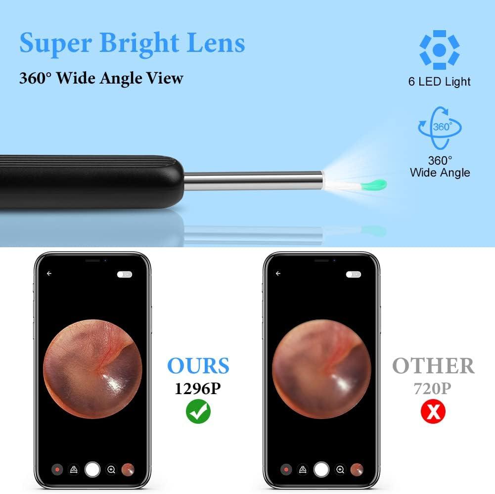ACWOO Wireless Ear Wax Removal Kit 1296P HD Otoscope | Visual Ear ...