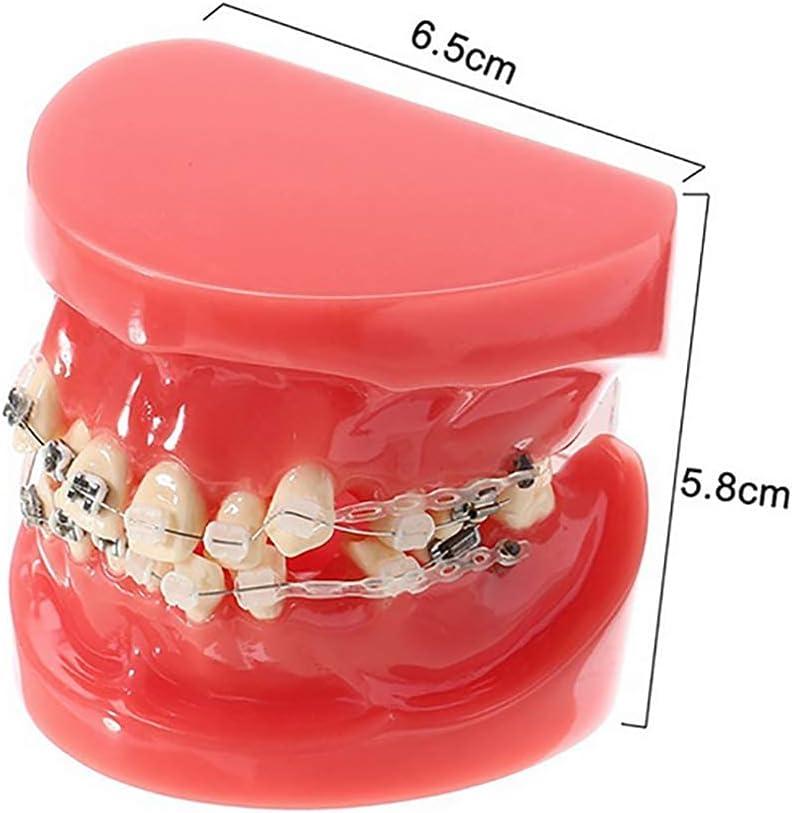 Buy Model Doll-10 Orthodontic Braces for Adults | Ceramic Demonstration ...