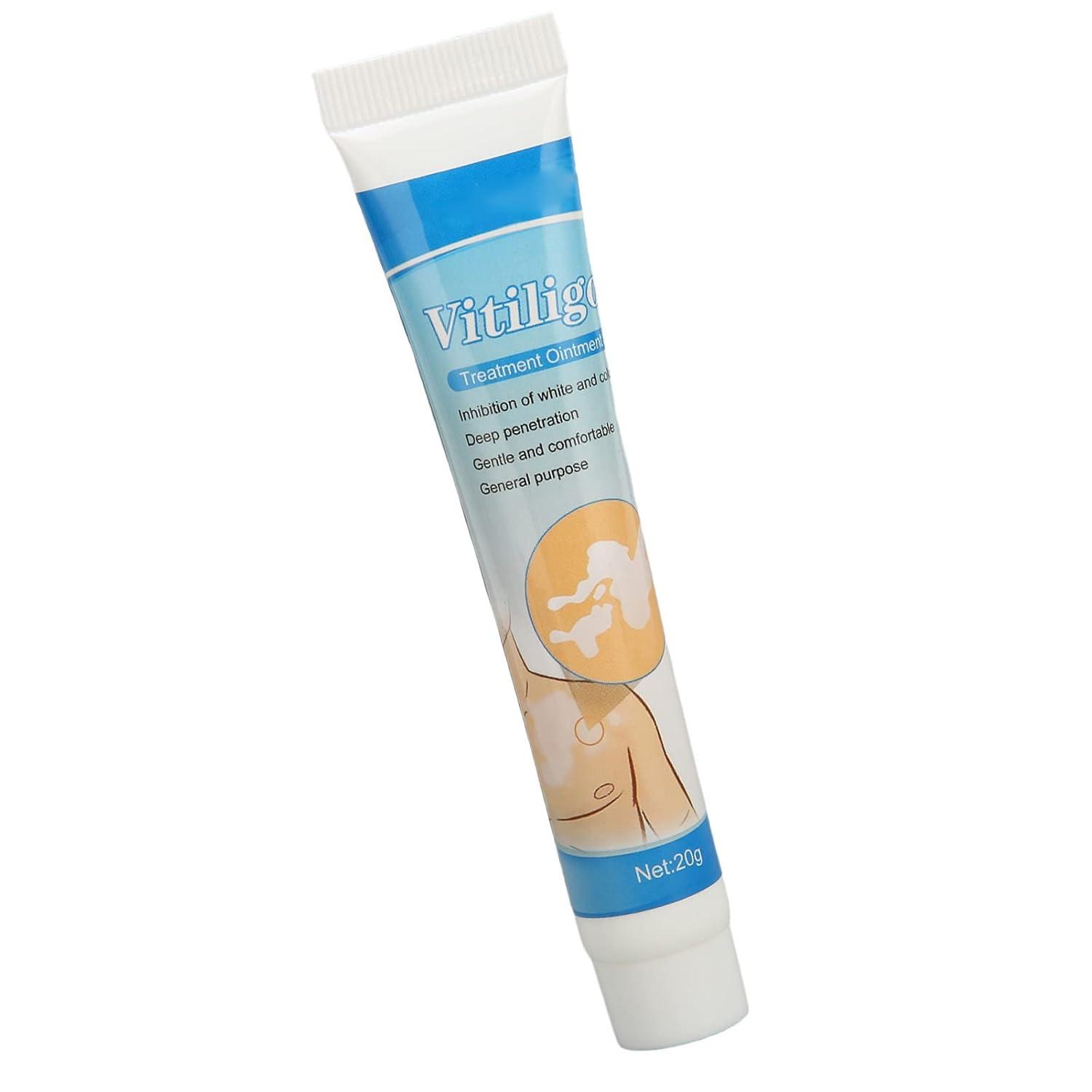 LIULDASHUN Vitiligo Cream - Natural Herbal Extract Treatment Ointment ...