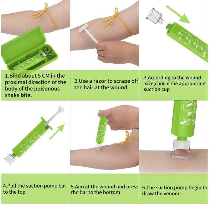 Floverkity Bug Bite Suction Tool - Venom Extractor for Fast Itch Relief ...