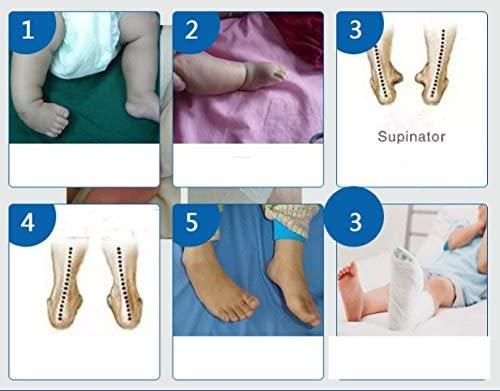 Kids AFO Drop Foot Brace Night Splint - Toddler Ankle Foot Support ...