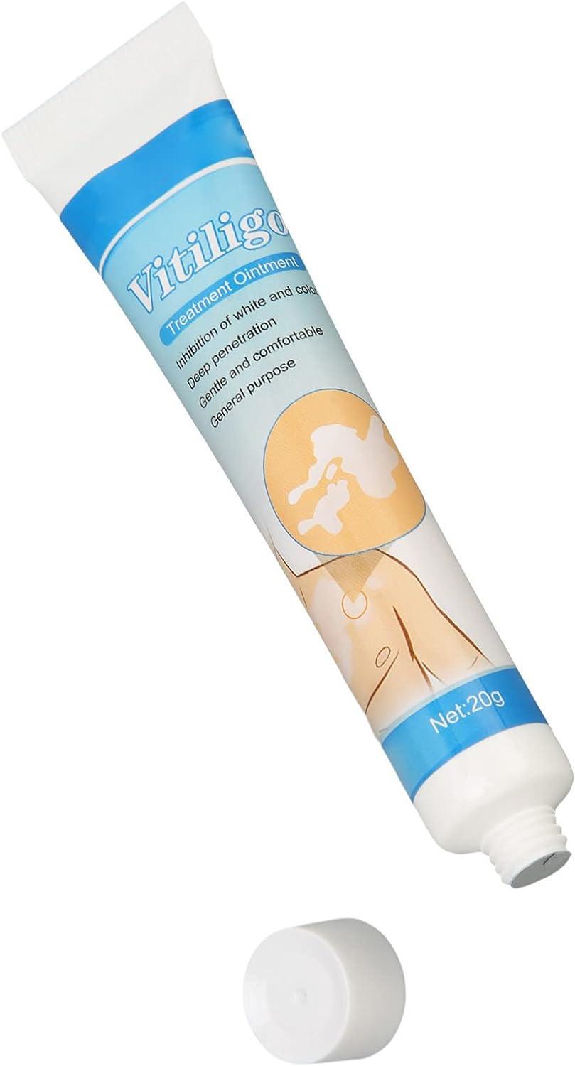 Herbal Vitiligo Cream 0.7oz - Skin Pigmentation Treatment Ointment ...