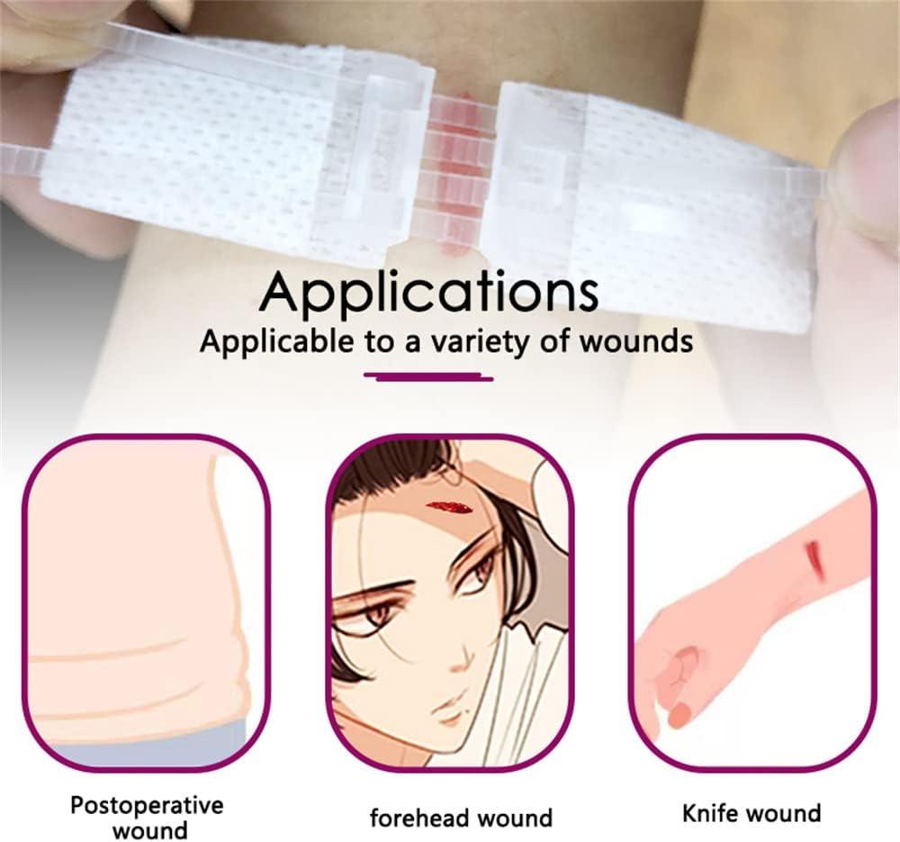 Emergency Wound Closure Kit - Zip Stitch Band-Aid Laceration Repair ...