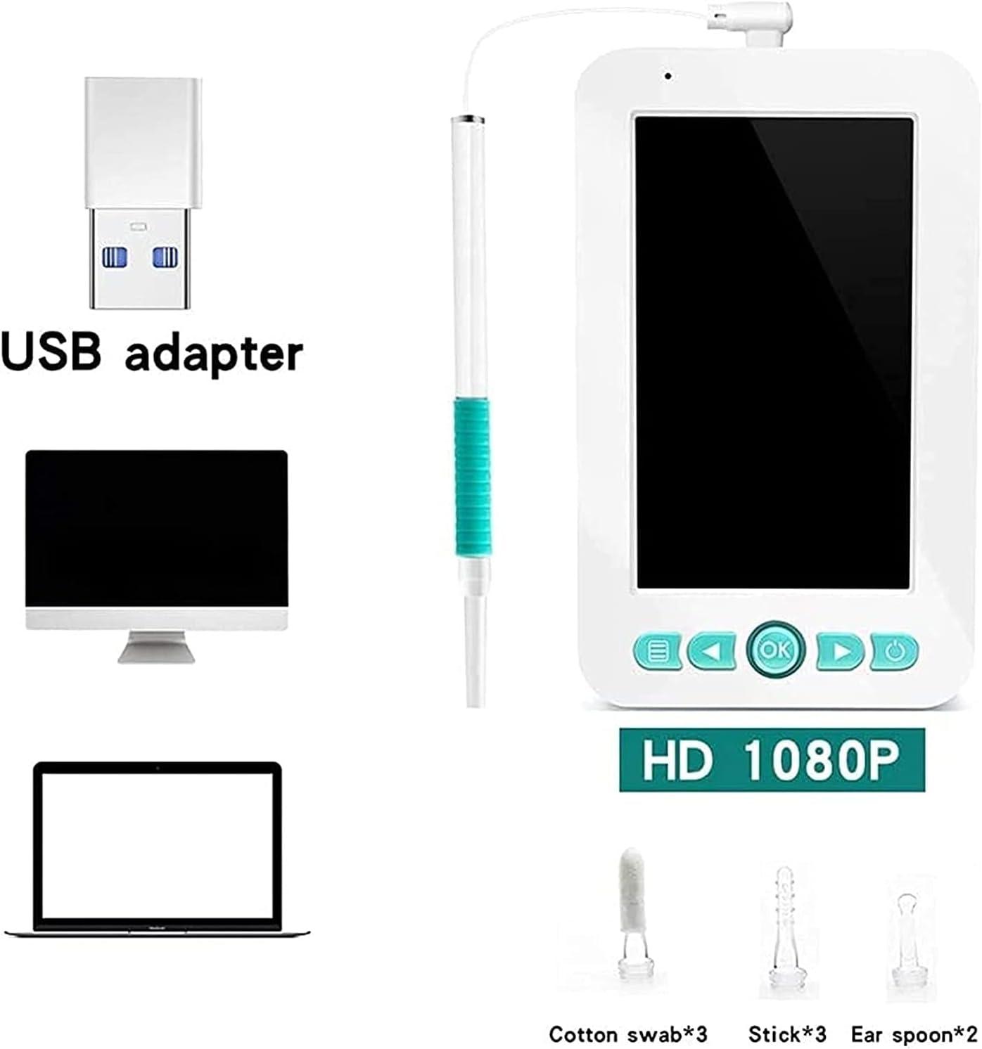 Jteremy Digital Otoscope 4.3 Screen, 6 LED Lights, 5.5mm Camera, IP67 ...