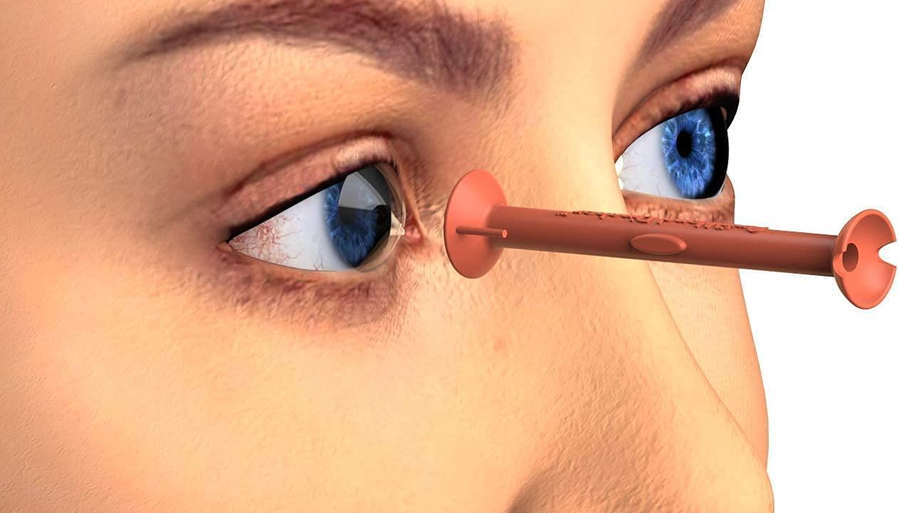 OptiWand Pincher Soft Contact Lens Tool - Insertion and Removal Device ...