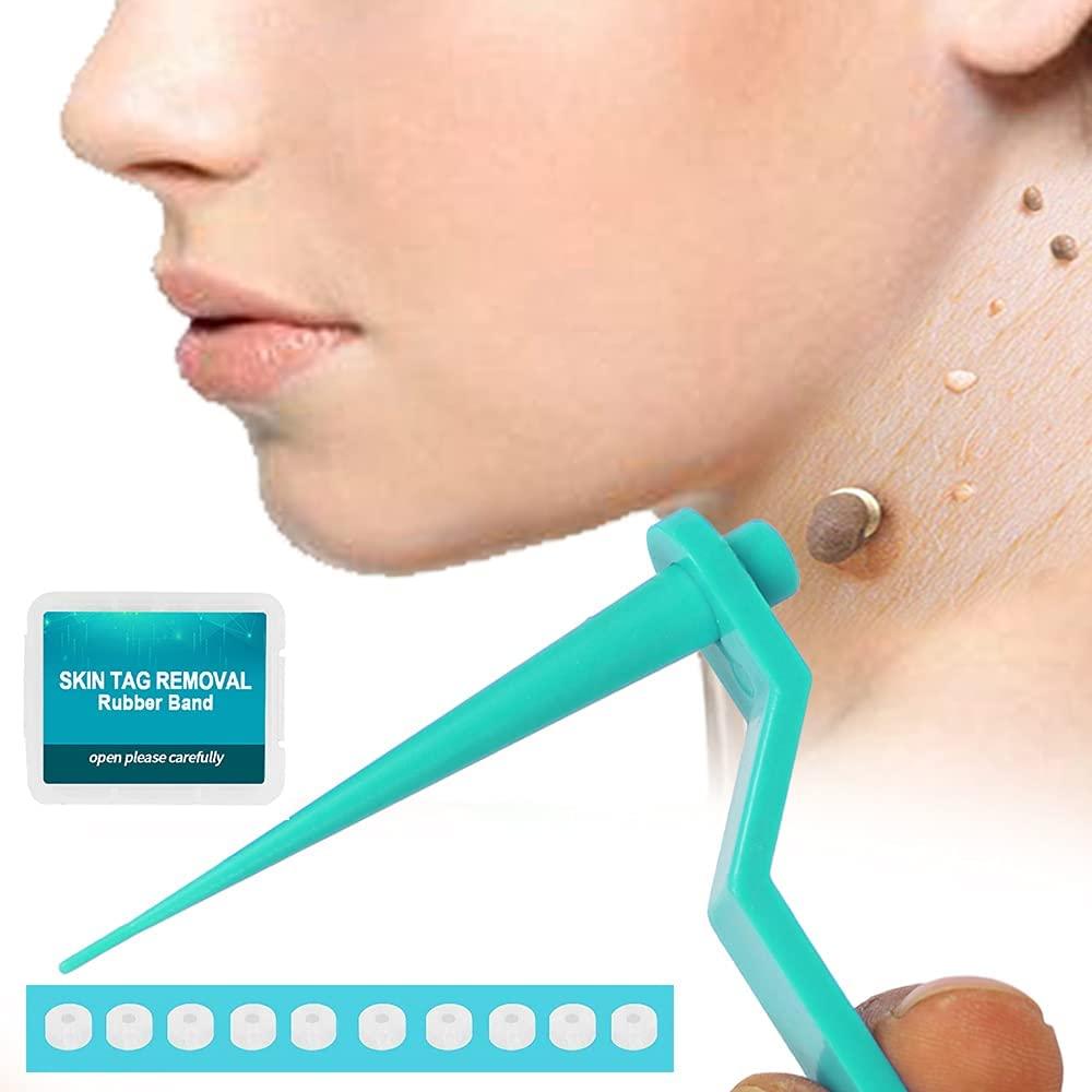 77PCS Skin Tag Remover for 2-5mm Skin Tag, Skin Tag Remover Patches ...