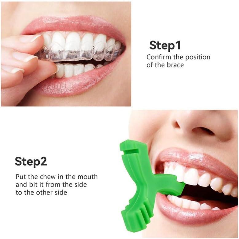 Y-Shaped Chewies for Invisalign Aligners | Orthodontic Munchies (2 ...
