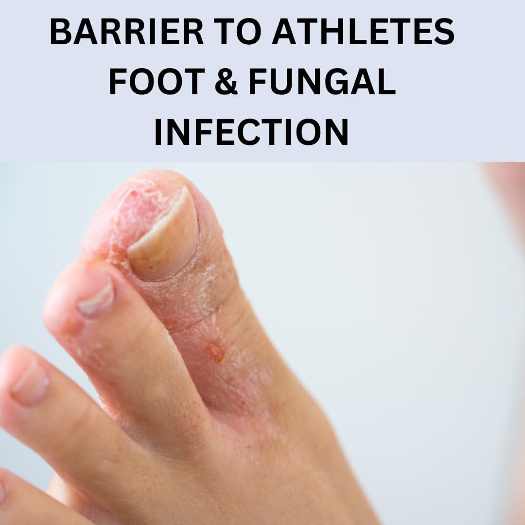 CannaFlex Antifungal Cream Sweat Rash Ringworm Skin Fungus Jock Itch ...