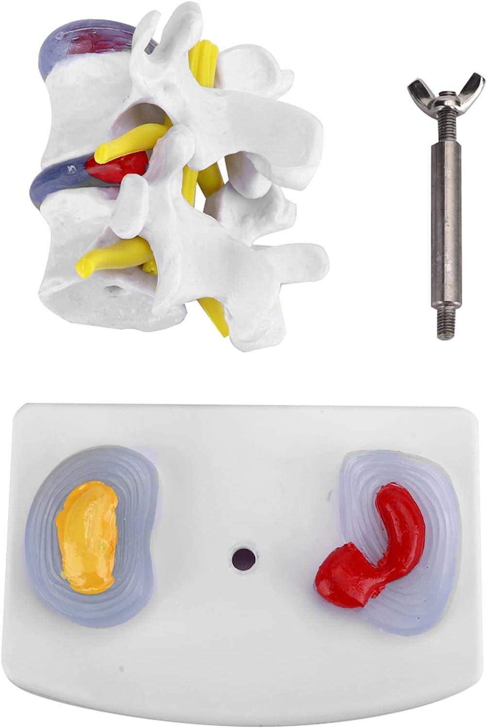Anatomical Lumbar Intervertebral Disc Model - Spine Demonstration for ...