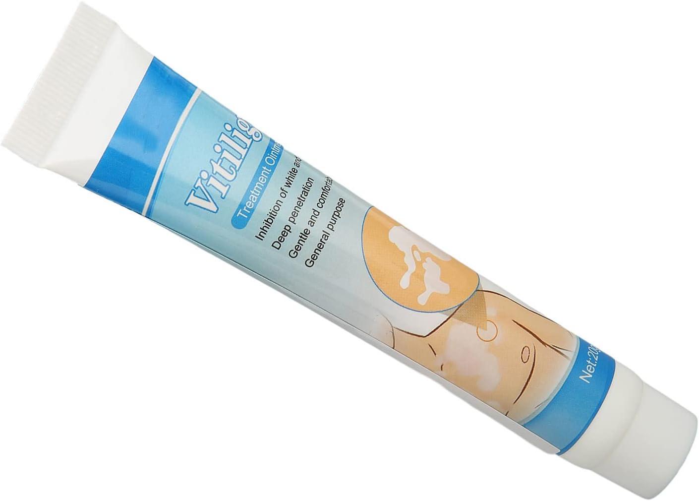 Vitiligo Treatment Cream 20g - Herbal Extract for White Spots & Skin ...