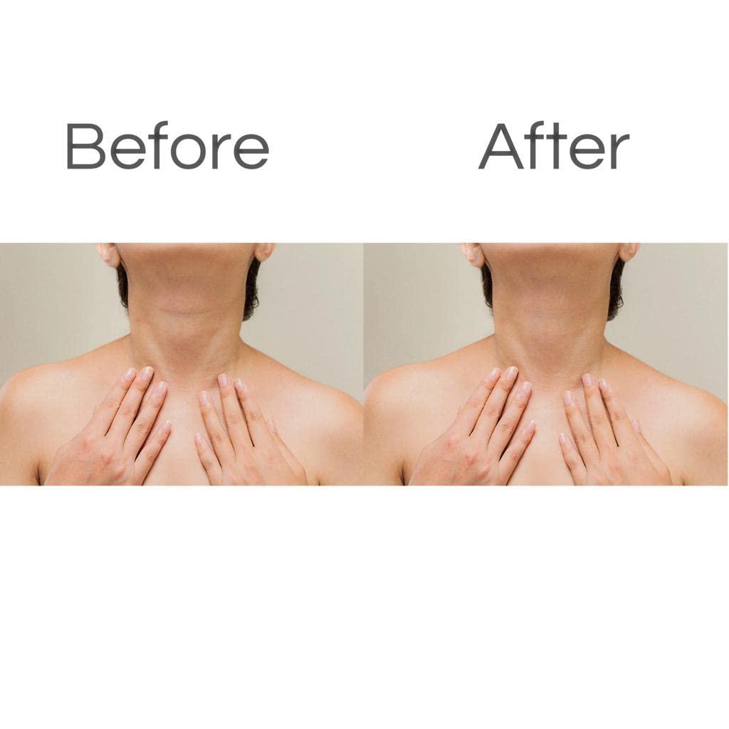 Anti-Aging Silicone Neck & Chest Wrinkle Patches - Skin Firming ...