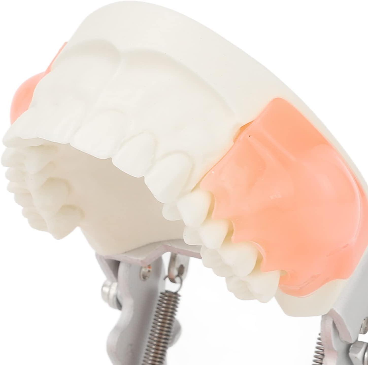 Verdant Touch Cyst Tooth Model | Professional Dental Study ...