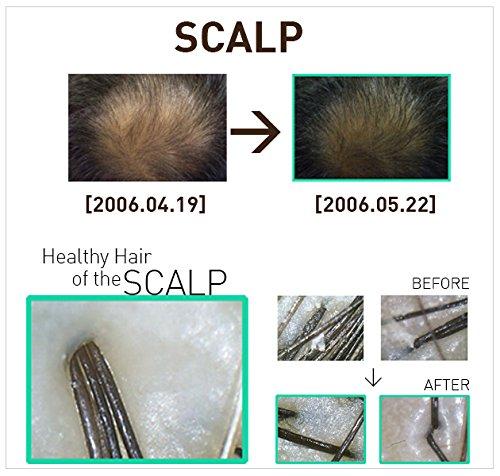 Dr Ross' BIOGEM Hair Loss Care Set - Shampoo & Conditioner 10oz ...