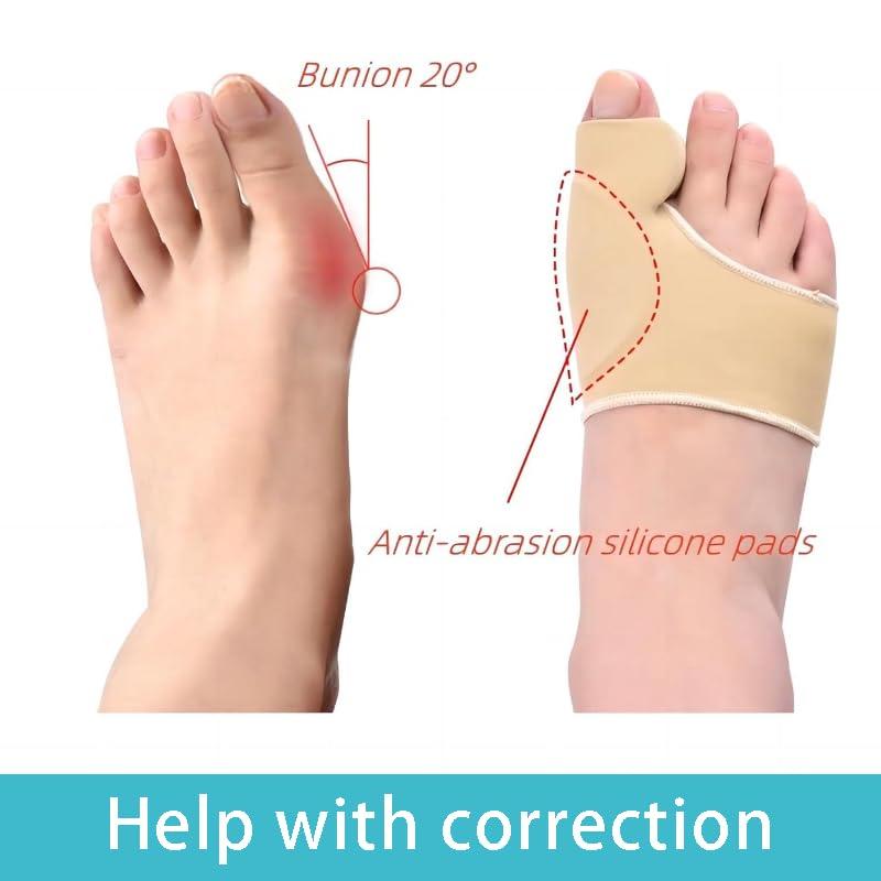 Hallux Valgus Bunion Corrector Bandage - Skin Color Silicone Toe ...