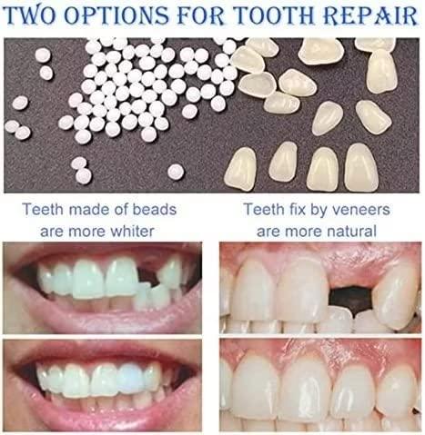 Womcare Temporary Tooth Repair Kit - Fill Missing/Broken Teeth & Gaps ...