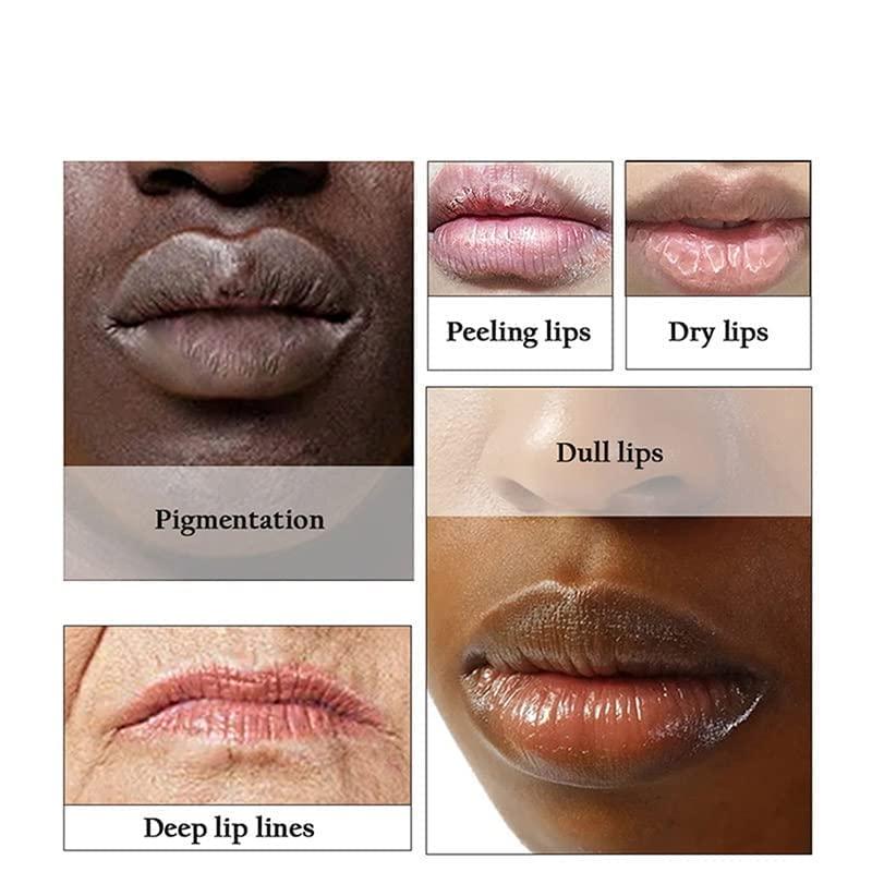 2PCS Lip Pink Fresh Fast Lightening Balm for Dark Lips - Effective ...